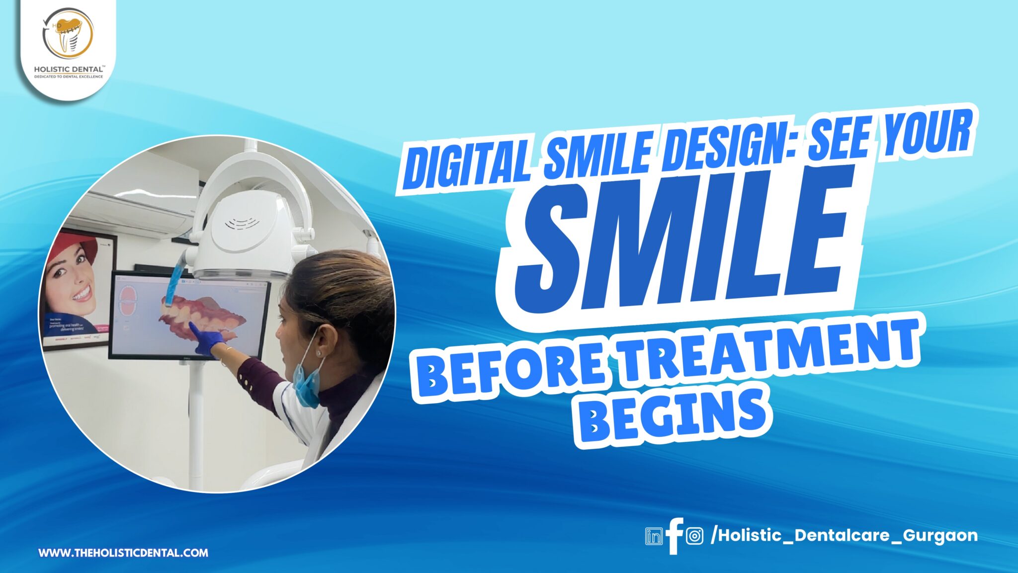 Digital Smile Design: See Your New Smile Before Treatment Begins! - The ...